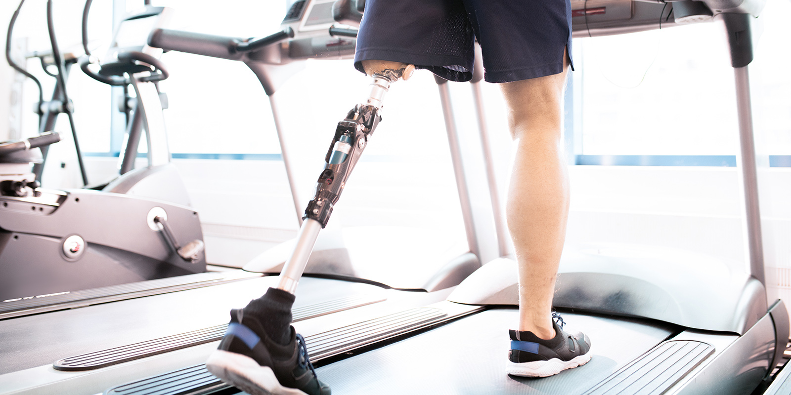 Arm- und Beinprothesen in Graz-Umgebung - Orthopädie Zieser